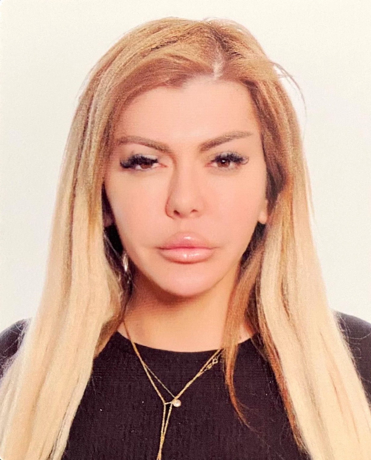 Our Team – NIPS Albania